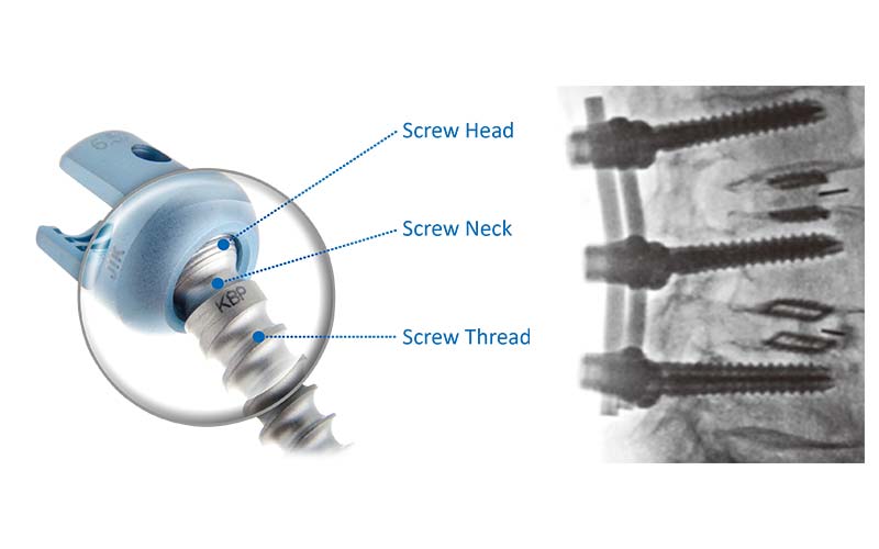 冠亞生技 - SmartLoc Evolution System